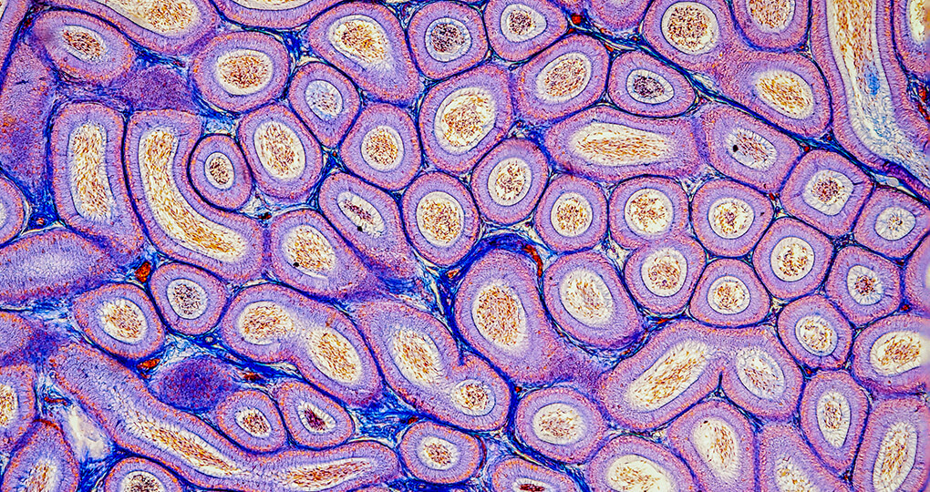 ヒト全エクソームシーケンス（WES） | Gene Nex – 次世代シーケンス受託解析サービス「ジーンネックス」